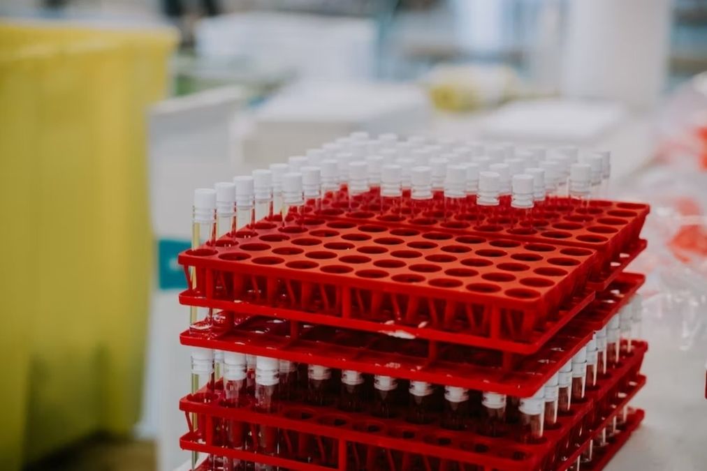 AstraZeneca придбає Gracell - якою буде сума угоди - Бізнес
