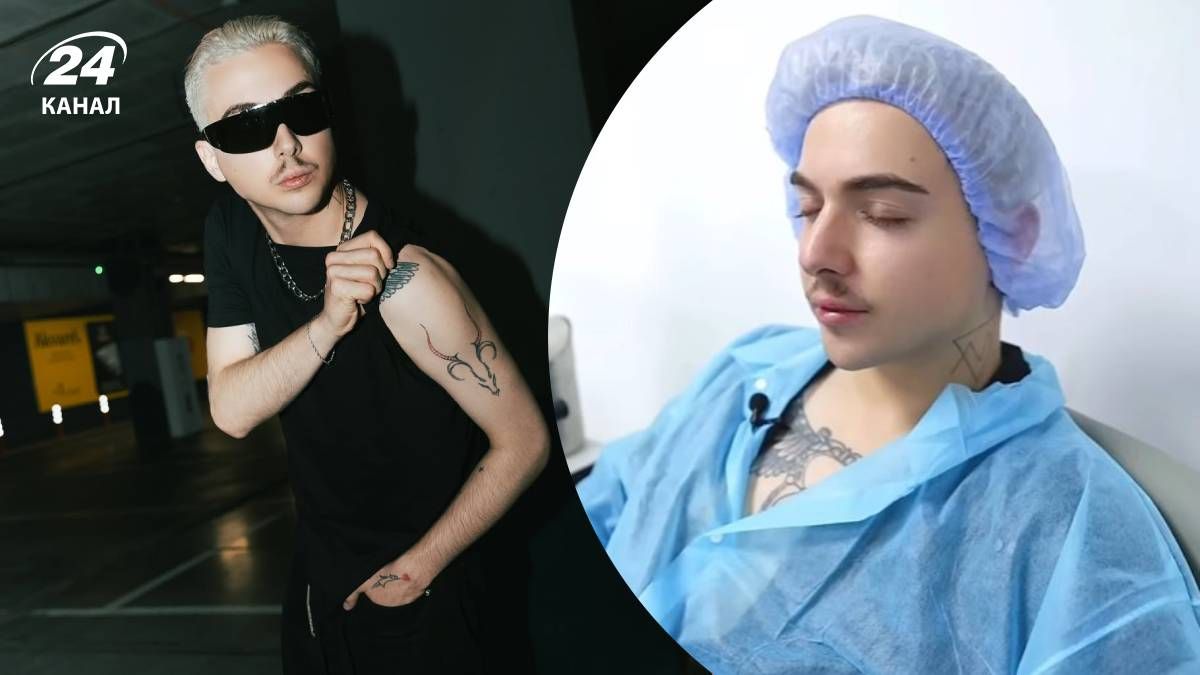 Melovin сделал лазерную коррекцию зрения - певец поделился подробностями - Show24